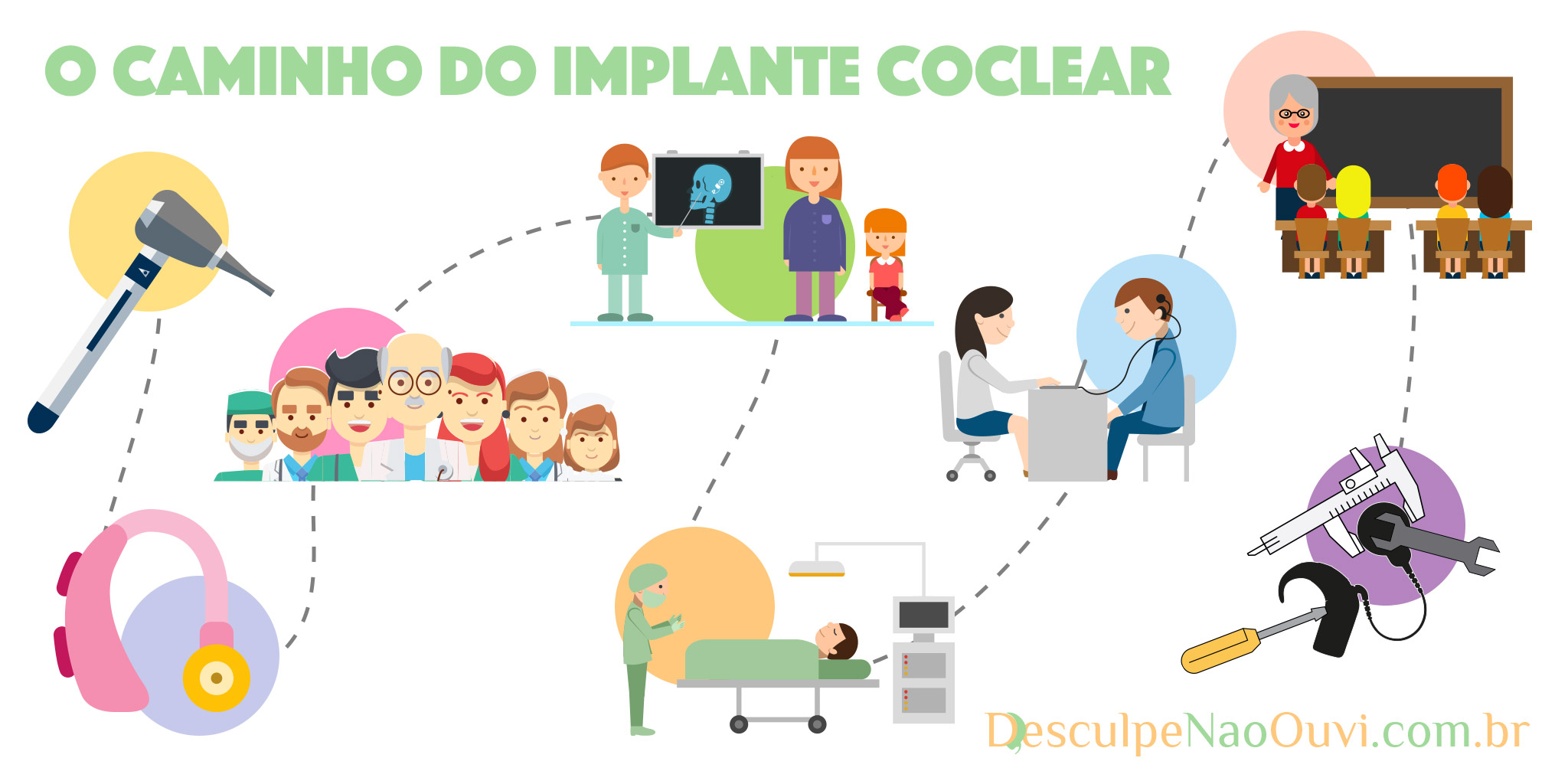 Como funciona o processo do implante coclear – Lak Lobato